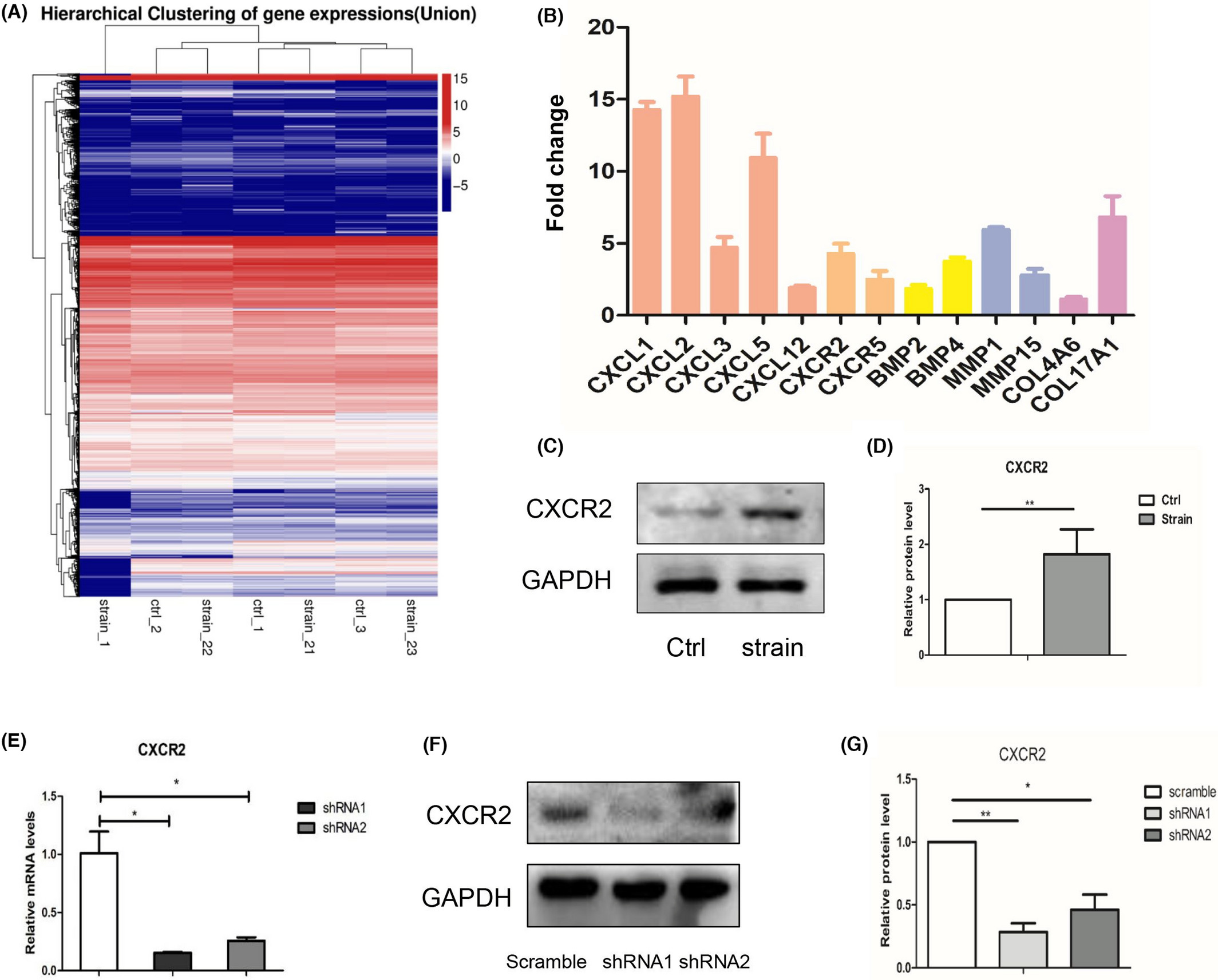 CXC-受体2在机械应变下促进细胞外基质的产生并减弱视盘周围人巩膜成纤维细胞的迁移